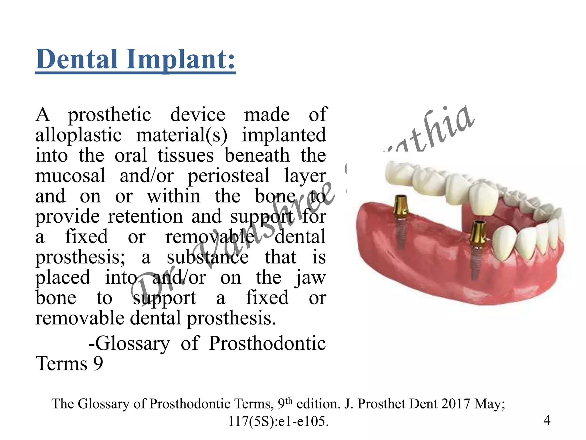 Classification and Types of Craniofacial Implants | PPTX