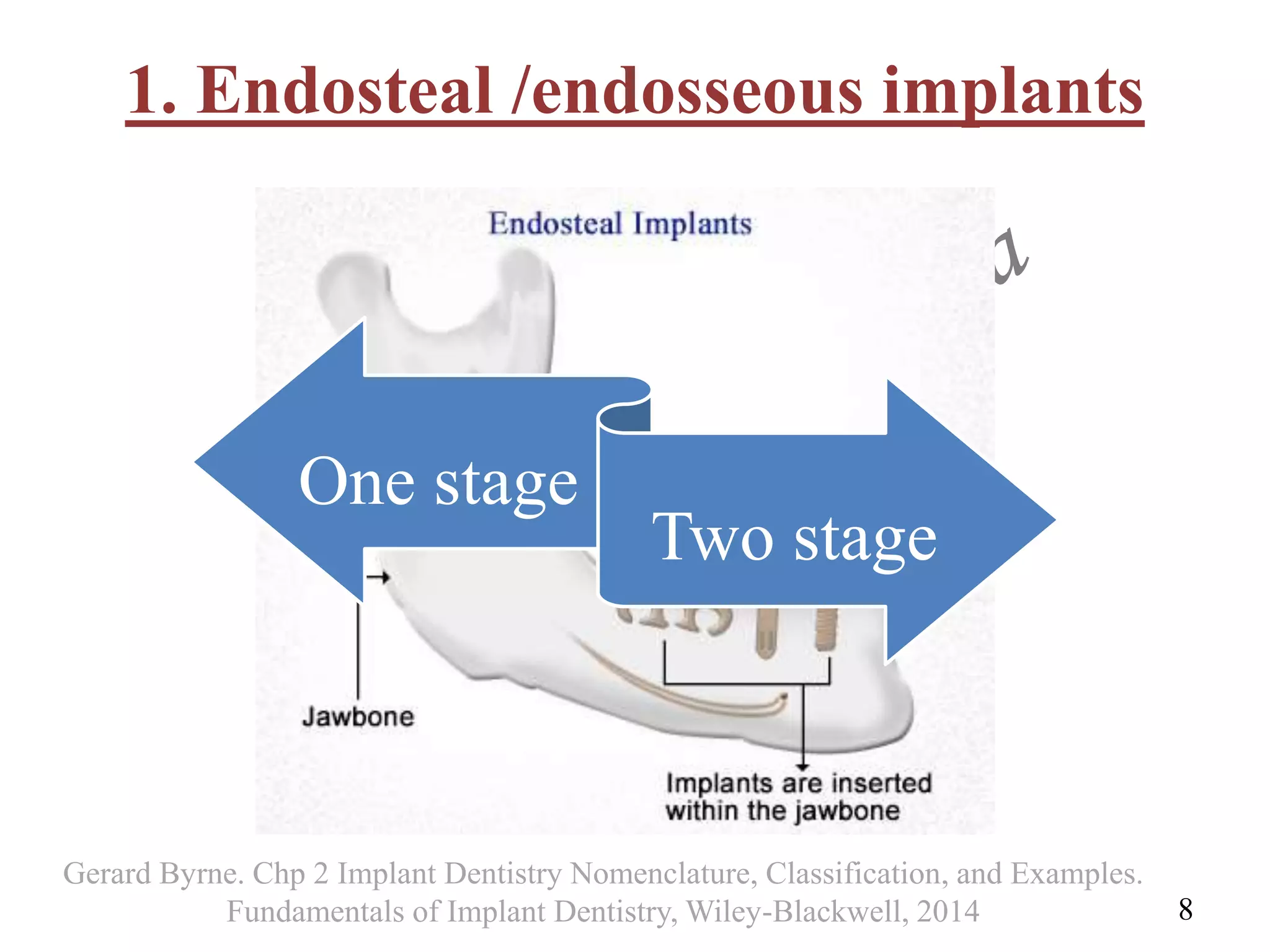 Classification and Types of Craniofacial Implants | PPTX