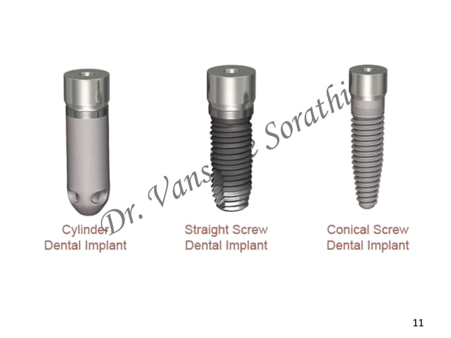 Classification and Types of Craniofacial Implants | PPTX | Oral care ...