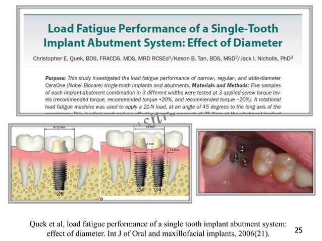 Classification and Types of Craniofacial Implants | PPTX | Oral care ...