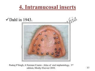 Classification and Types of Craniofacial Implants | PPTX