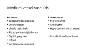 Classification,Approach,treatment of vasculitis.pptx