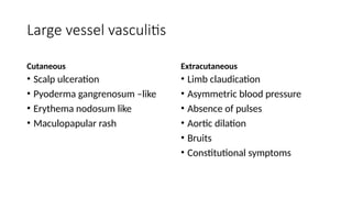 Classification,Approach,treatment of vasculitis.pptx