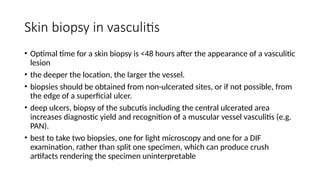 Classification,Approach,treatment of vasculitis.pptx