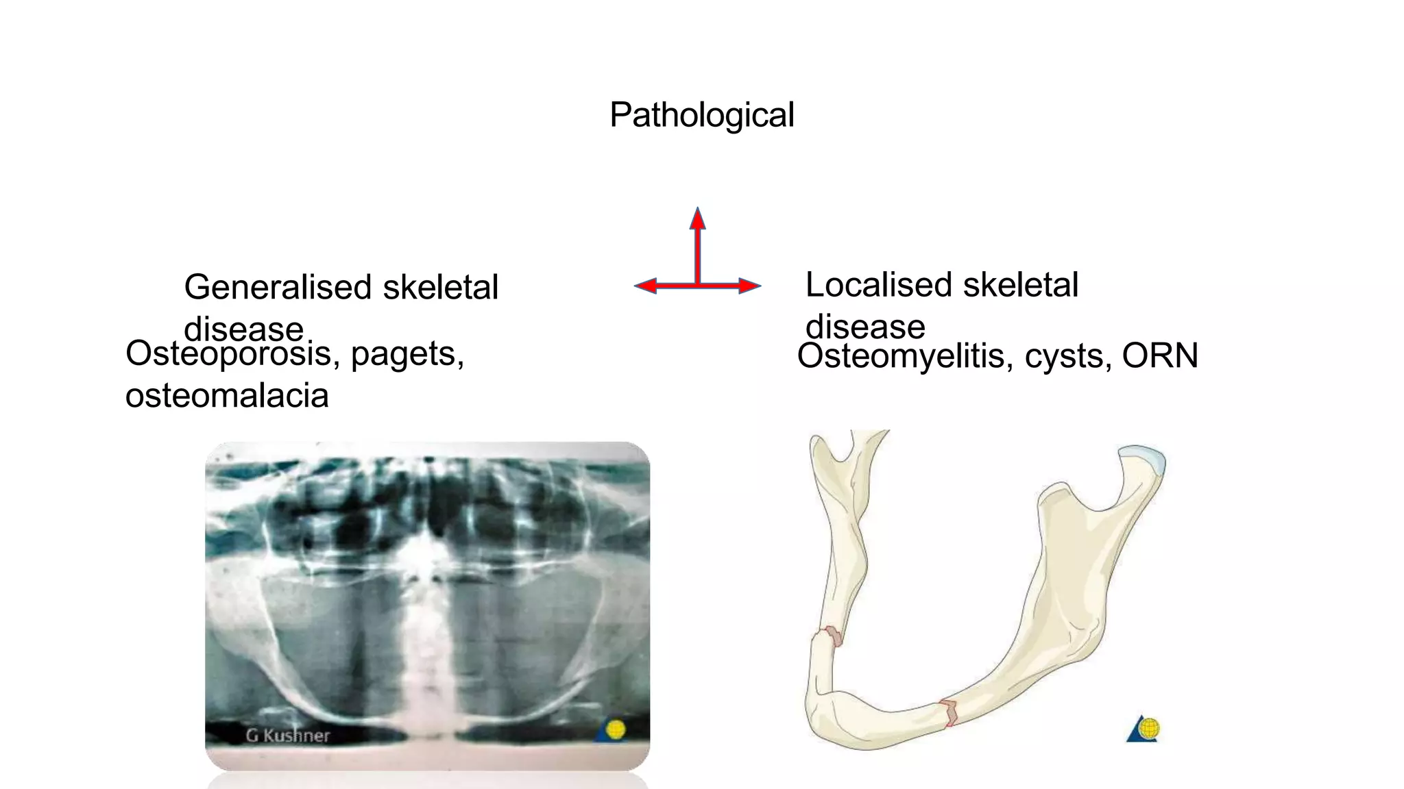Classification, clinical features of pan facial trauma | PPTX