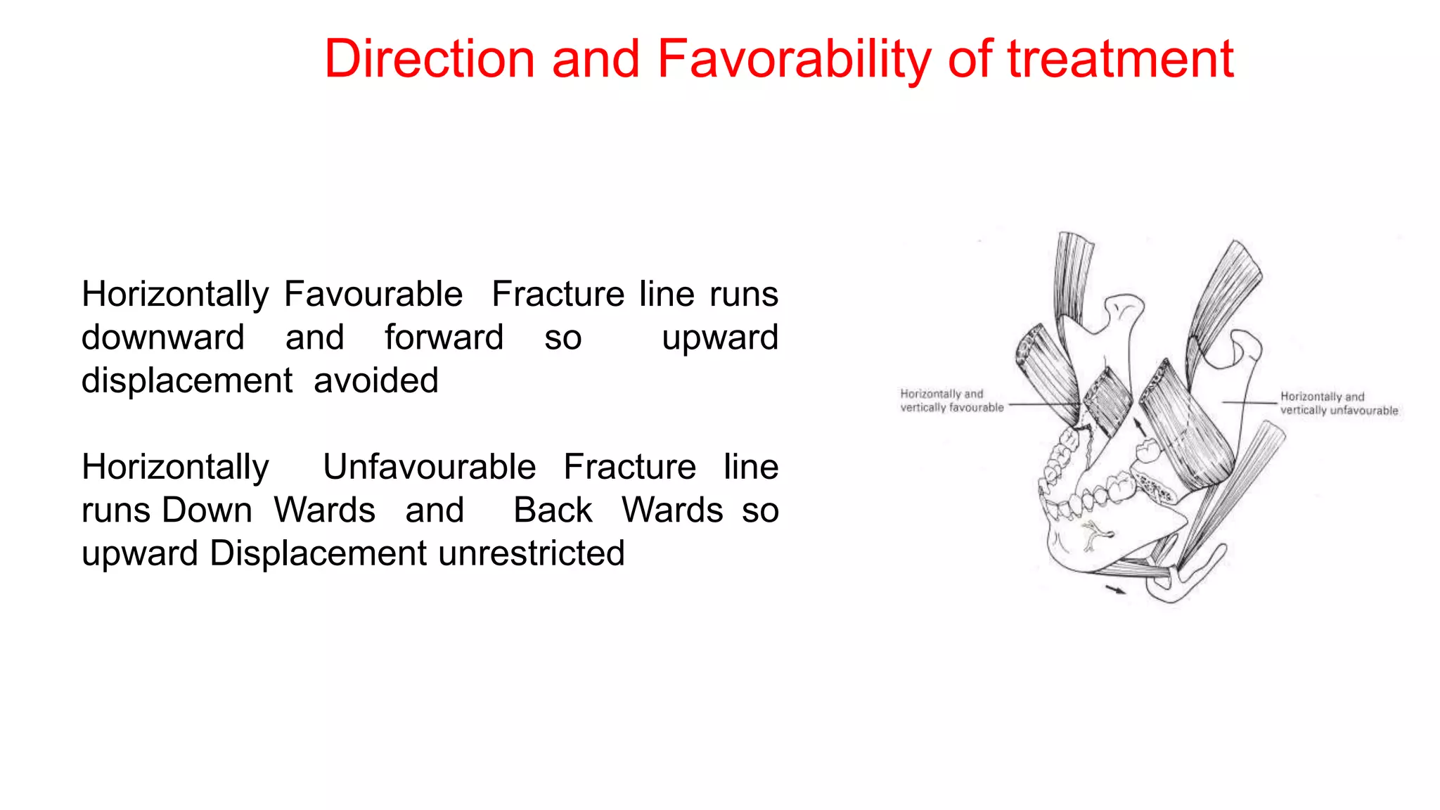 Classification, clinical features of pan facial trauma | PPTX