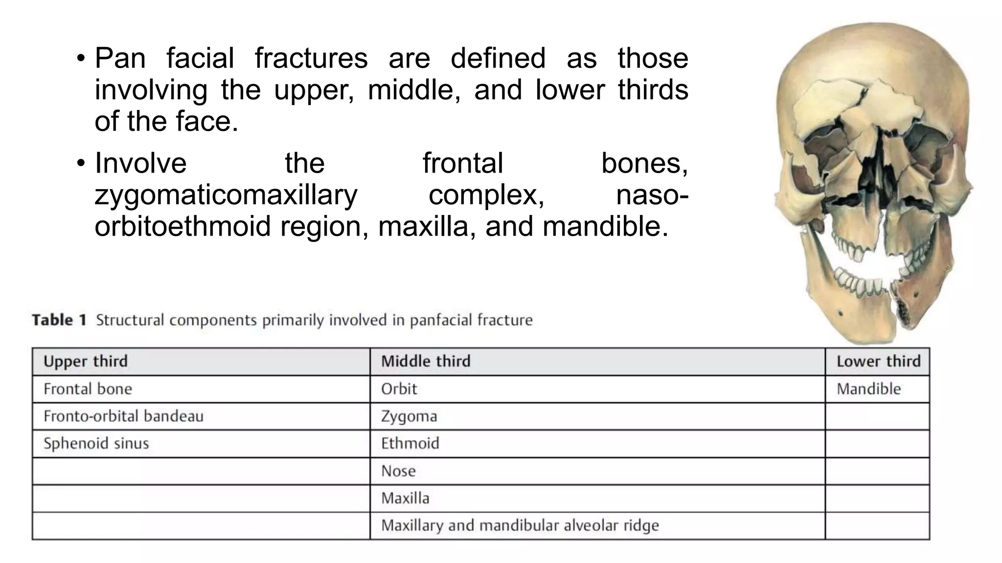 Classification, clinical features of pan facial trauma | PPTX