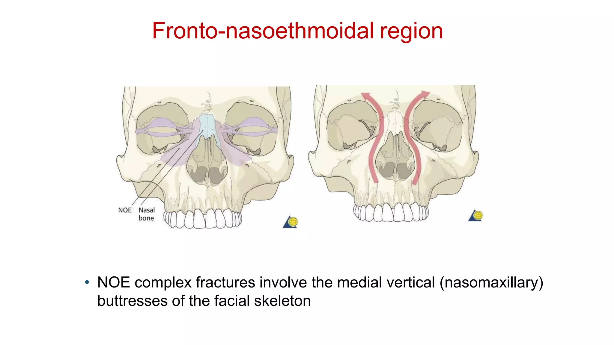Classification, clinical features of pan facial trauma | PPTX
