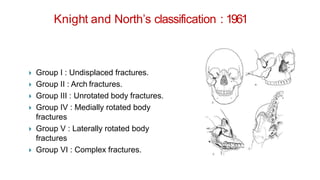 Classification, clinical features of pan facial trauma | PPTX