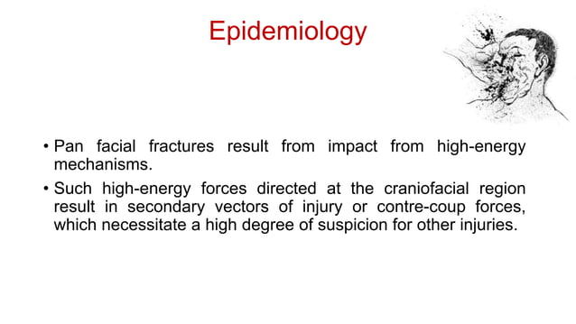 Classification, clinical features of pan facial trauma | PPTX