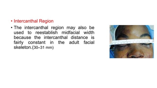 Classification, clinical features of pan facial trauma