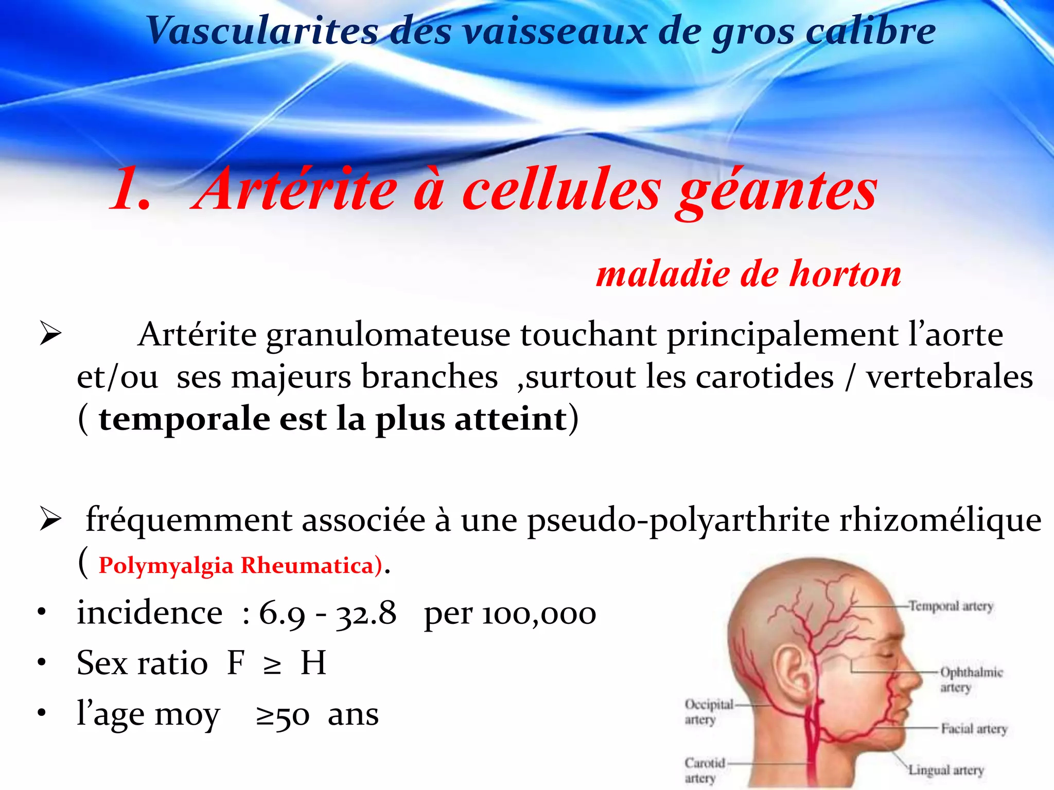 Classification of vasculitis