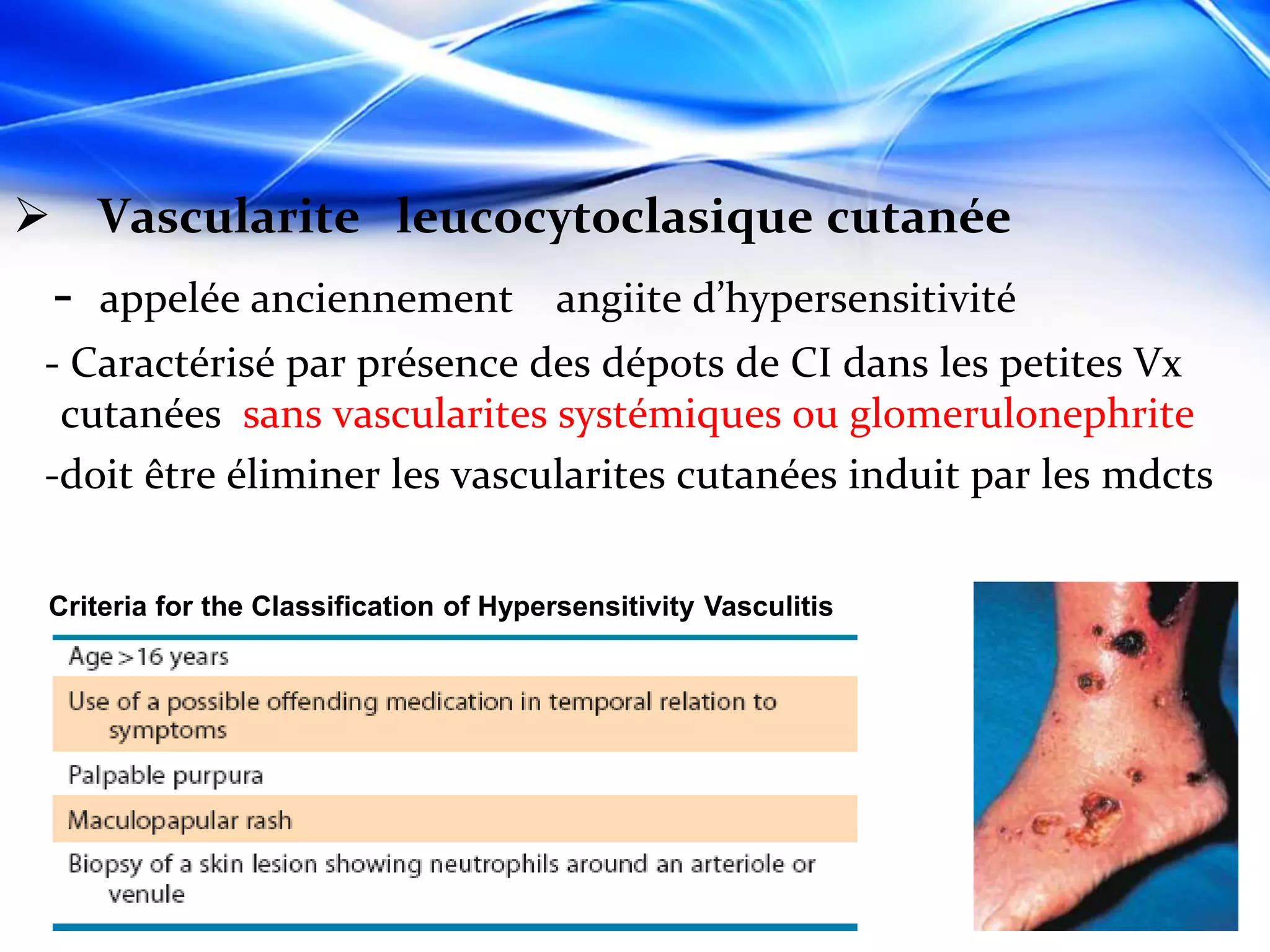 Classification of vasculitis