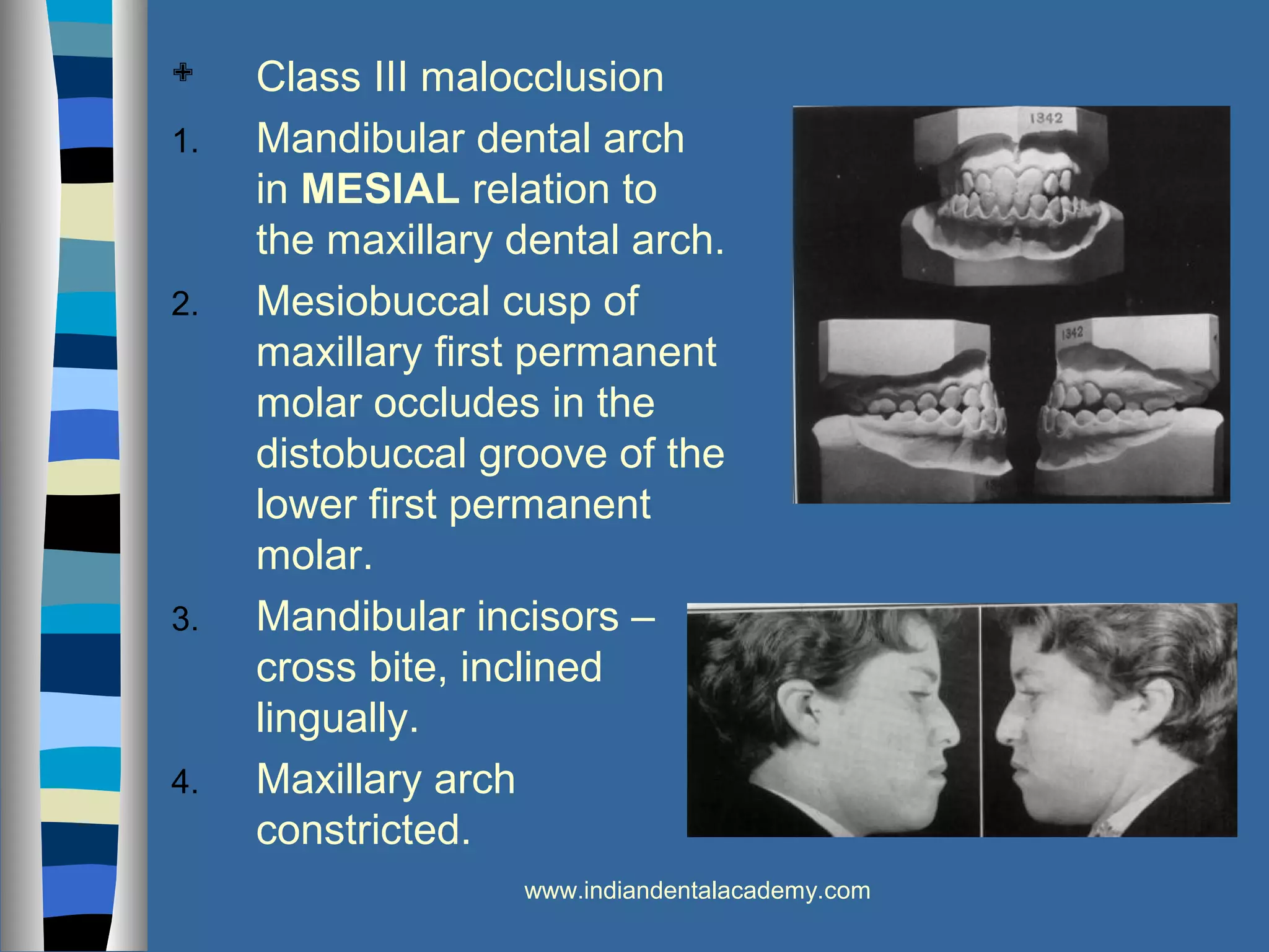 Classification & etiology of malocclusion | PPT
