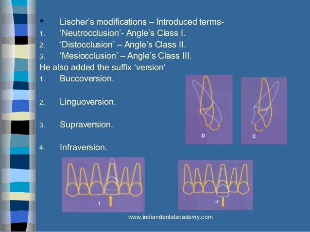 Classification & etiology of malocclusion