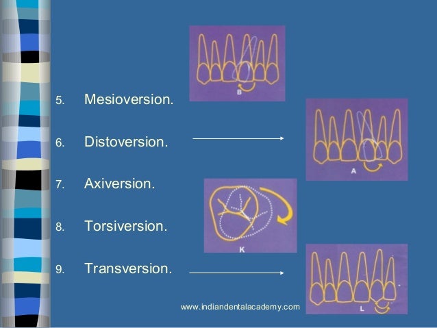 Classification & etiology of malocclusion