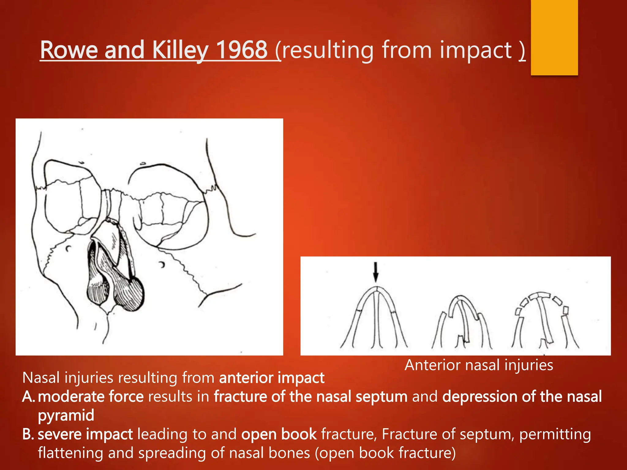 classificationfacialfracturekamini-200801184051.pptx