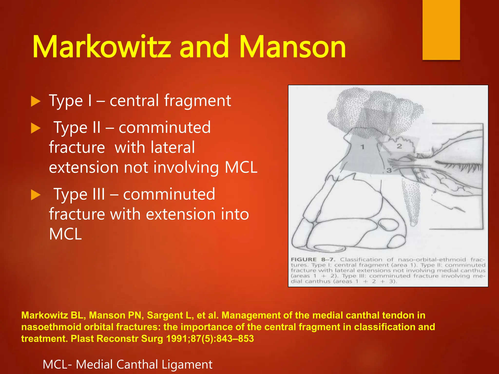 classificationfacialfracturekamini-200801184051.pptx