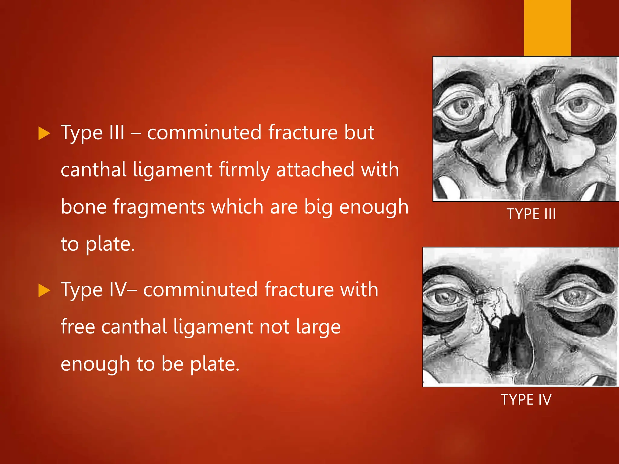 classificationfacialfracturekamini-200801184051.pptx