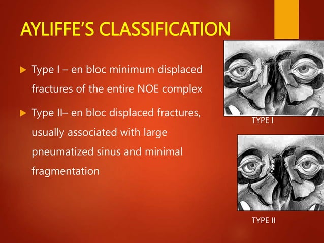classificationfacialfracturekamini-200801184051.pptx