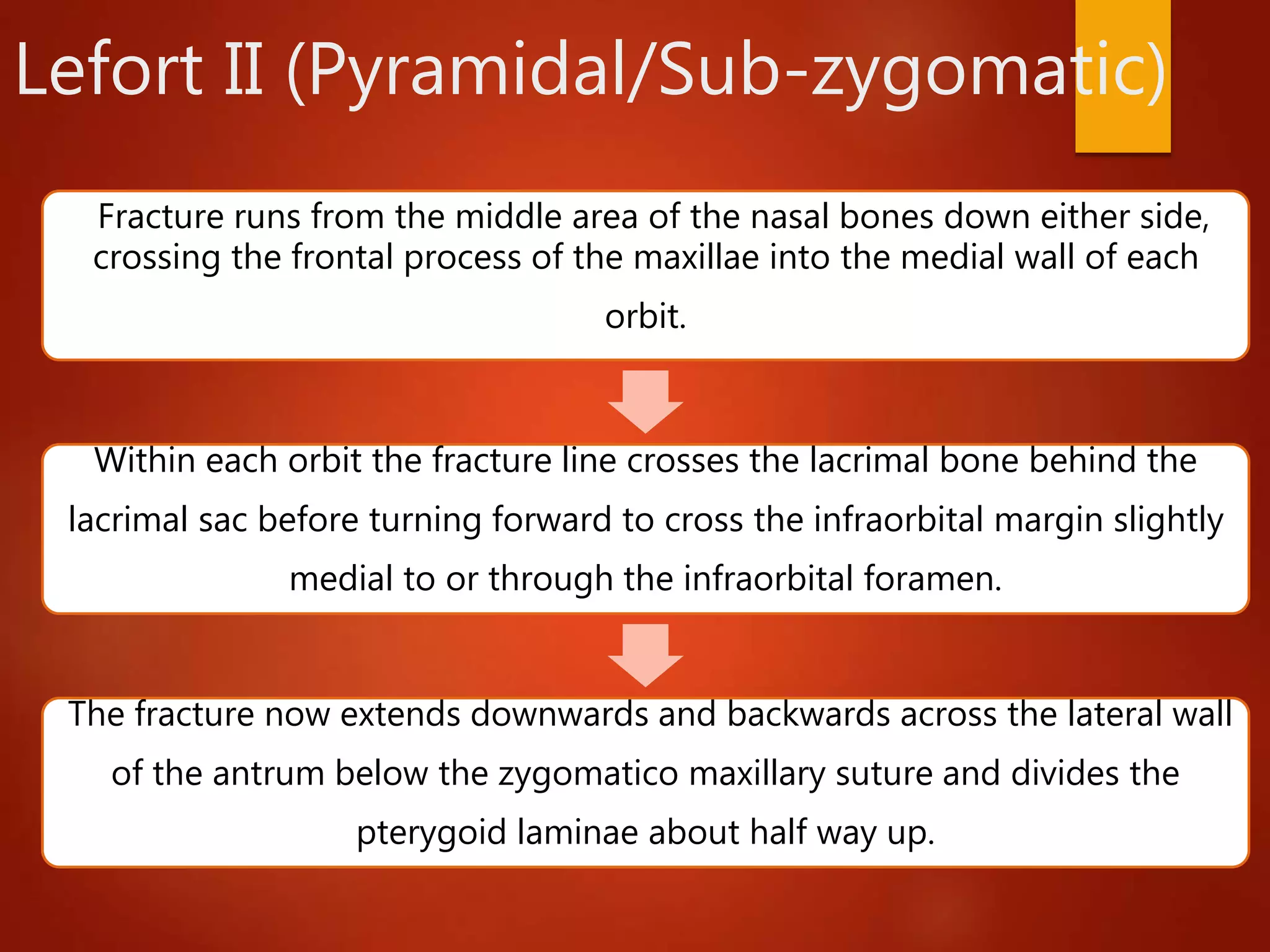 Classification facial fracture current concept | PPTX