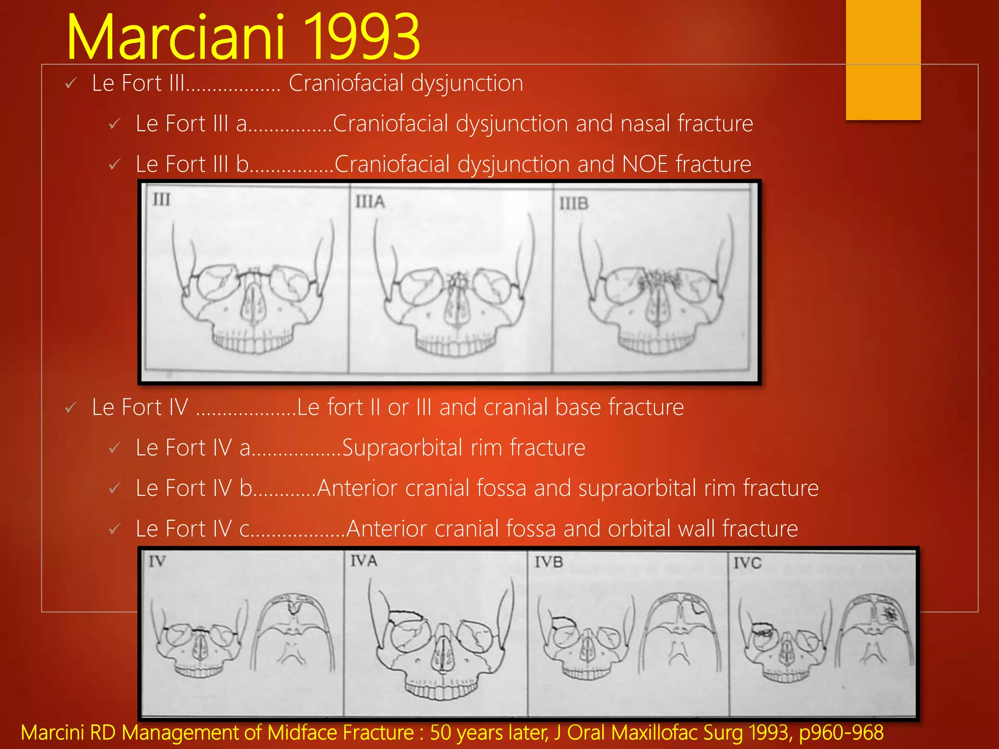 Classification facial fracture current concept | PPTX