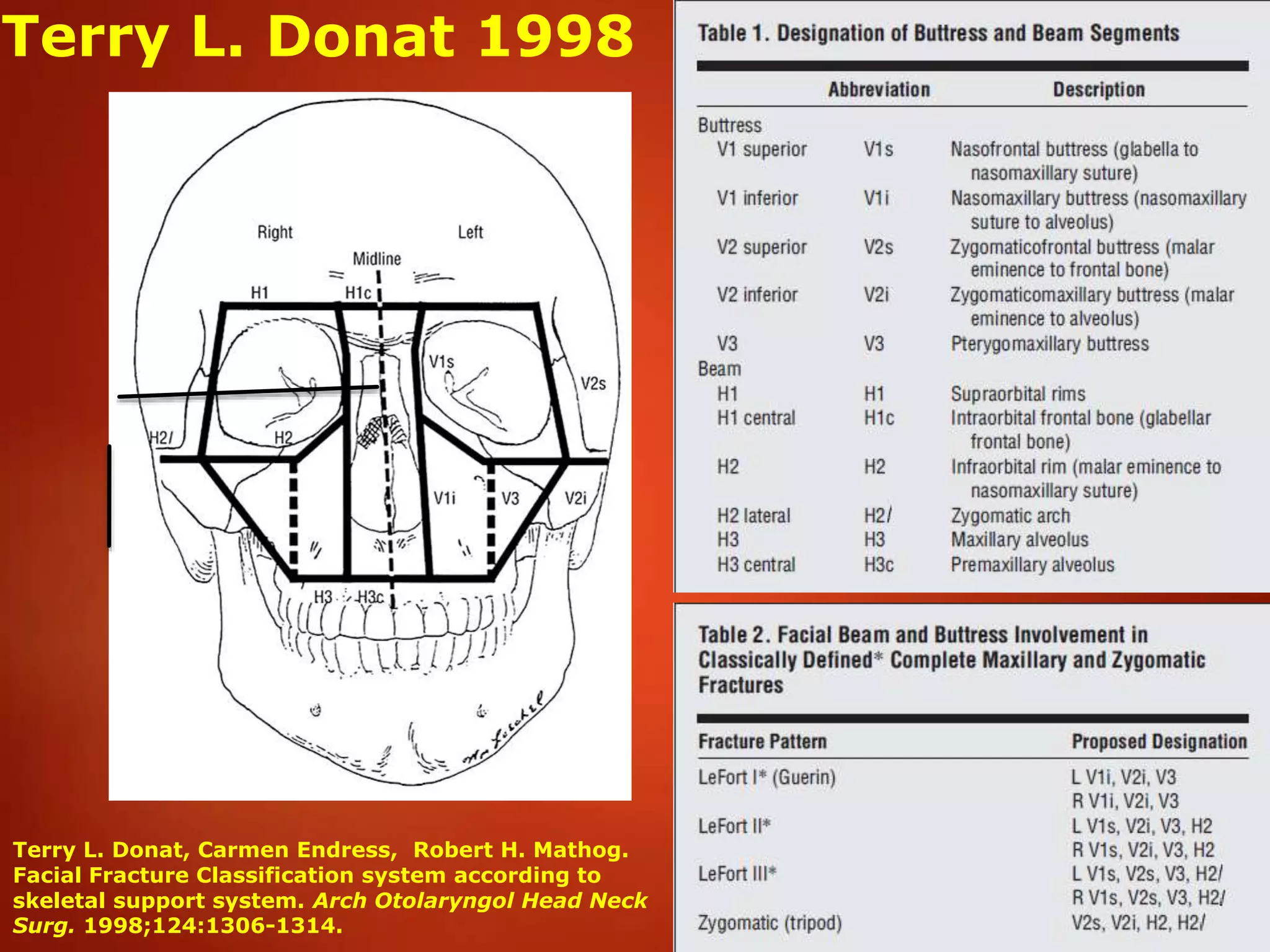 Classification facial fracture current concept | PPTX