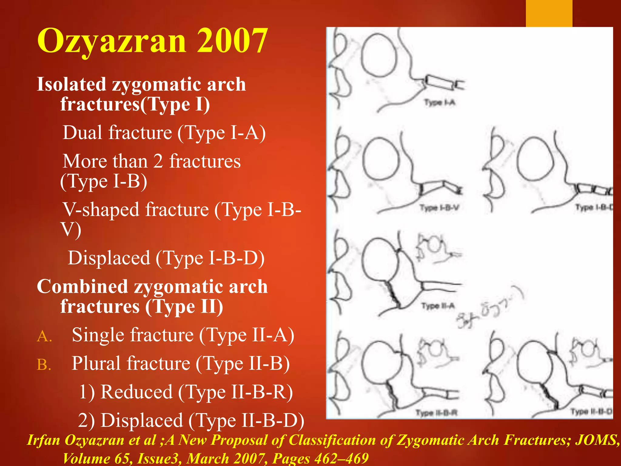 Classification facial fracture current concept | PPTX