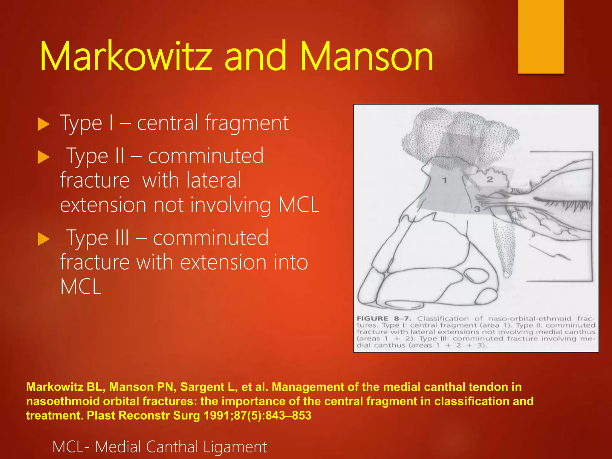 Classification facial fracture current concept | PPTX
