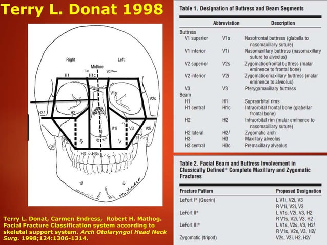 Classification facial fracture current concept | PPTX