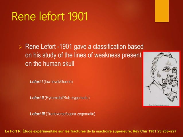 Classification facial fracture current concept | PPTX