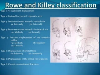Rowe Classification