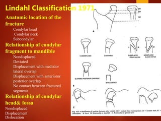 Classification facial fracture current concept | PPT