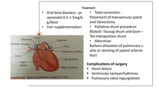 Classification, FetaL Circulation and TOF.pptx