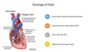 Classification, FetaL Circulation and TOF.pptx