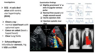 Classification, FetaL Circulation and TOF.pptx