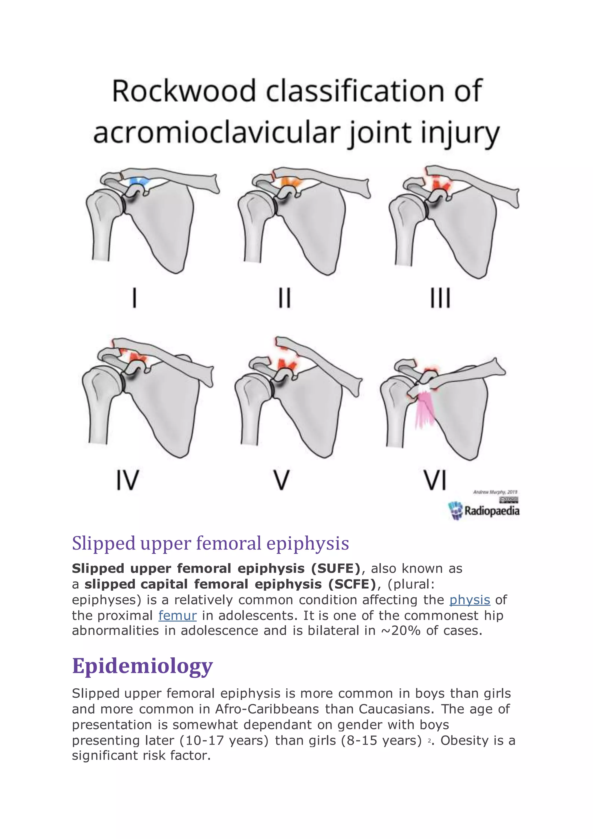 Important radiological classification of fracture and AVN | DOCX