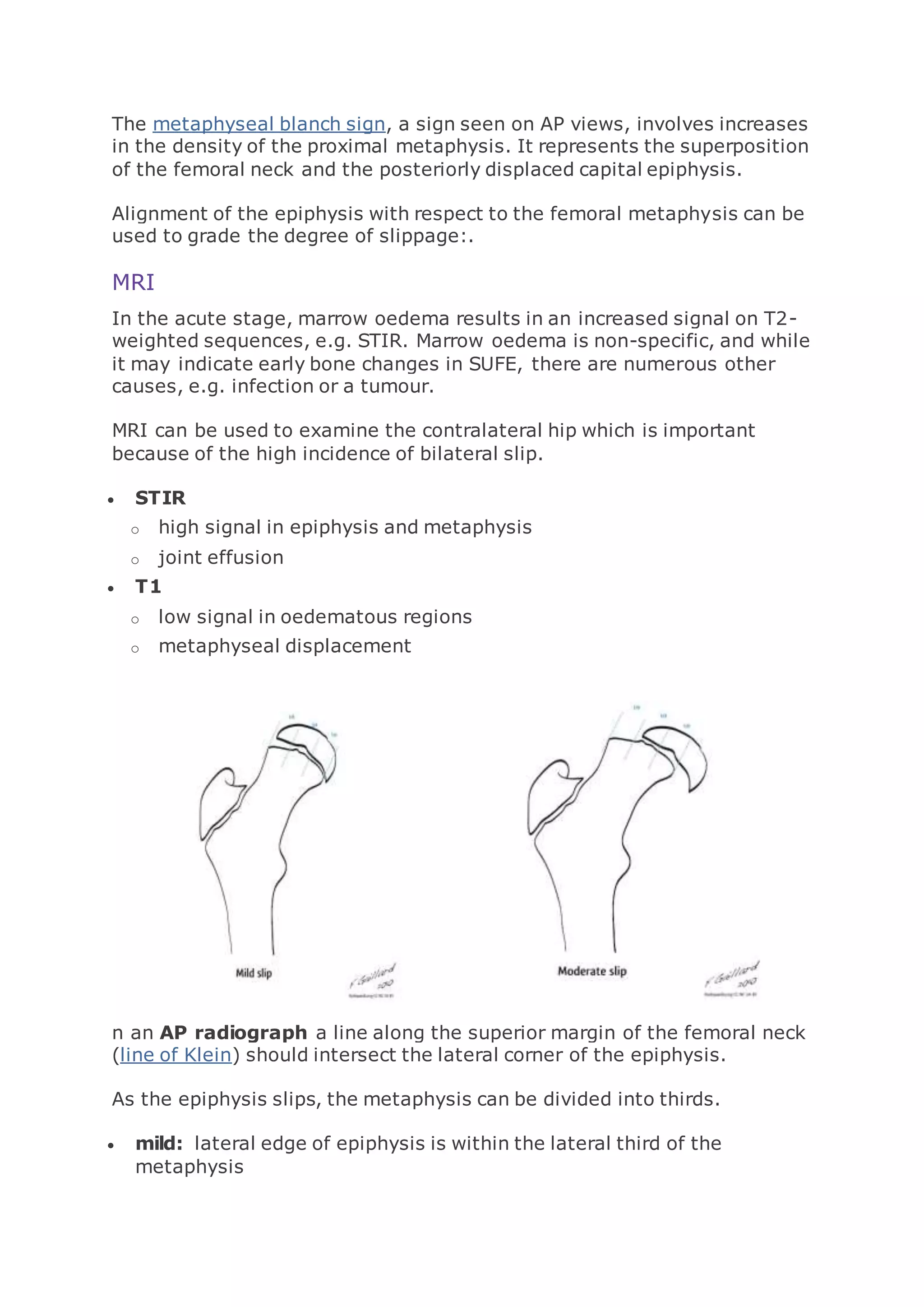 Important radiological classification of fracture and AVN | DOCX