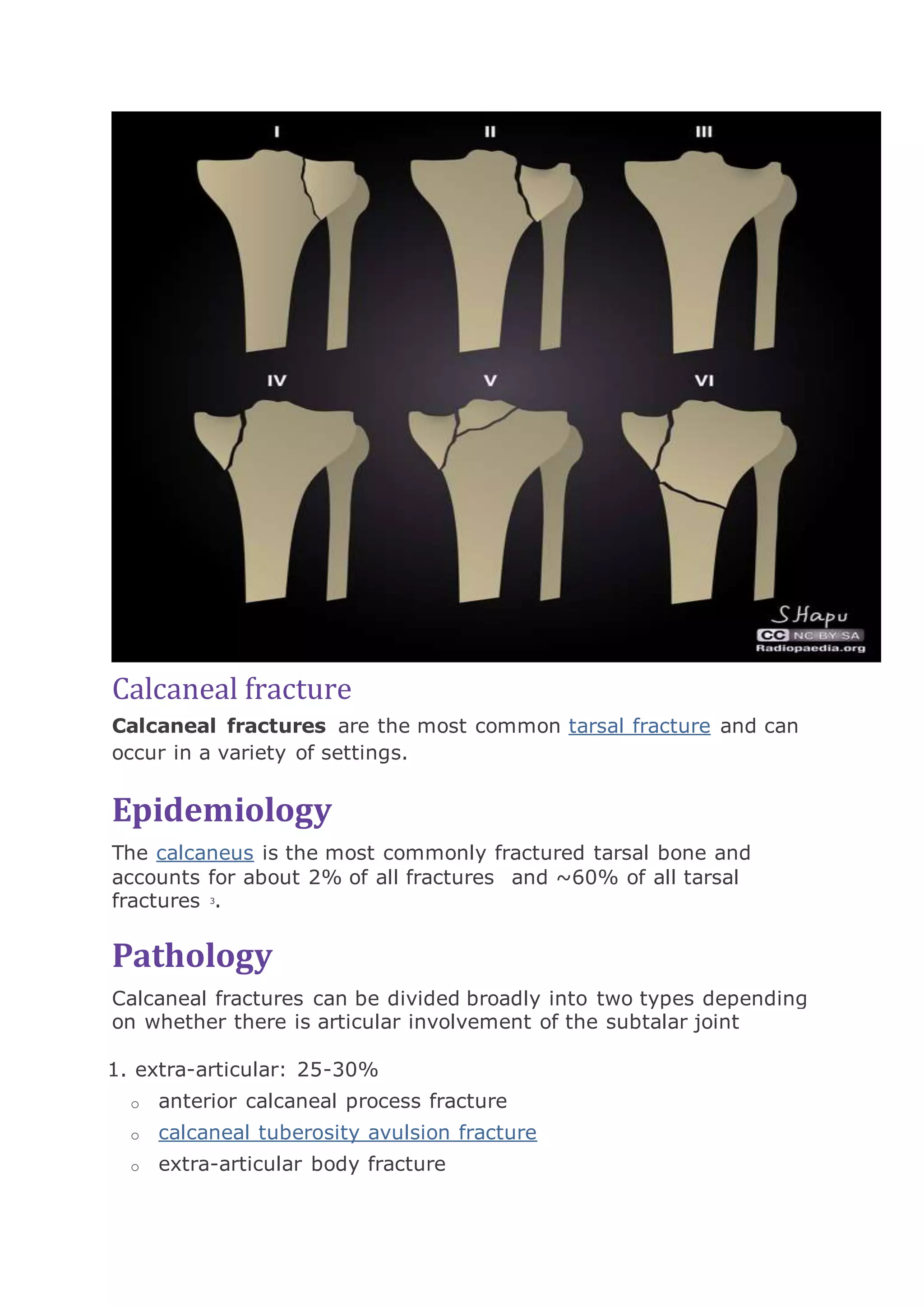 Important radiological classification of fracture and AVN | DOCX