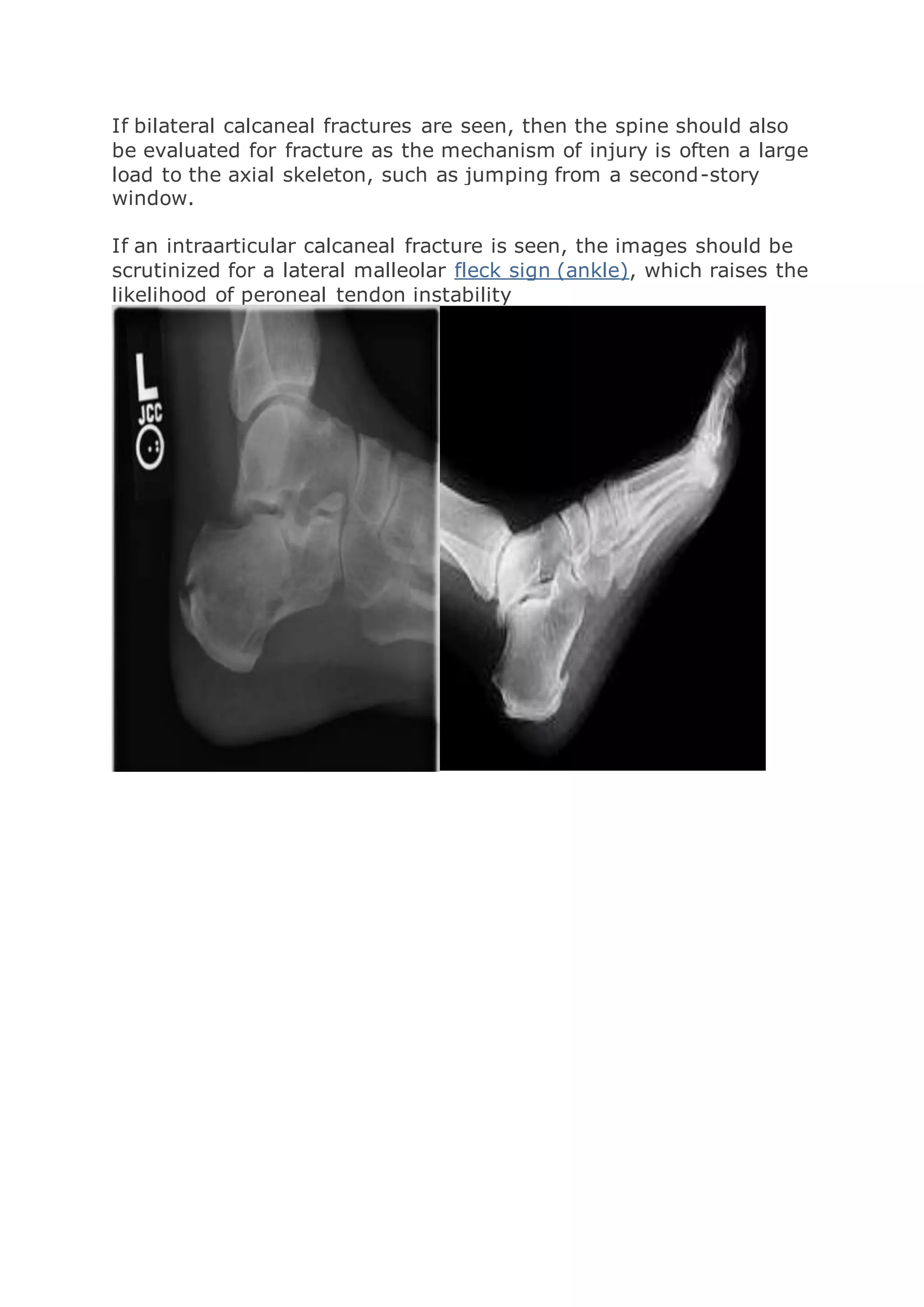Important radiological classification of fracture and AVN | DOCX