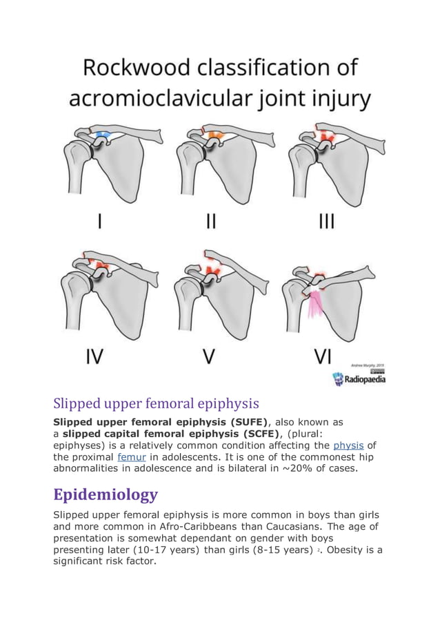 Important radiological classification of fracture and AVN | PDF