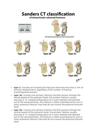 Important radiological classification of fracture and AVN | DOCX