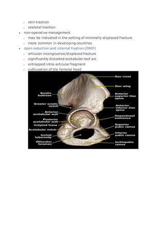 Important radiological classification of fracture and AVN | DOCX