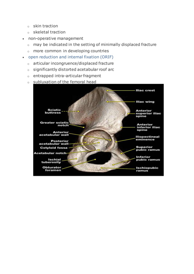 Important radiological classification of fracture and AVN | PDF