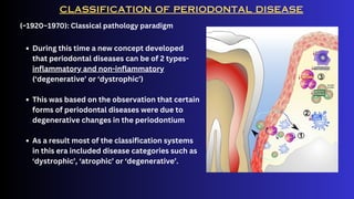 Classification of periodontitis | PDF