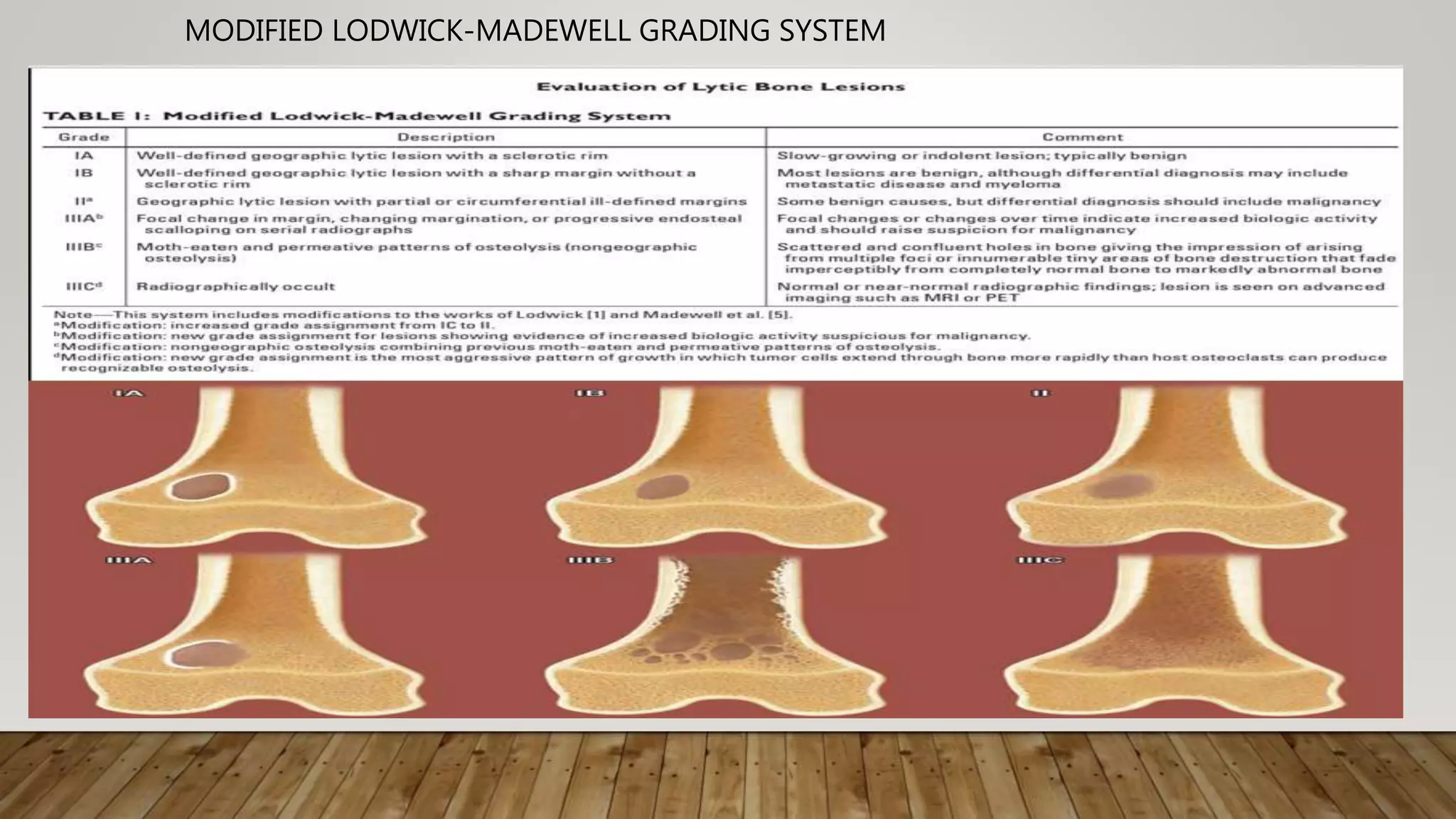 Classification in orthopaedic oncology | PPTX