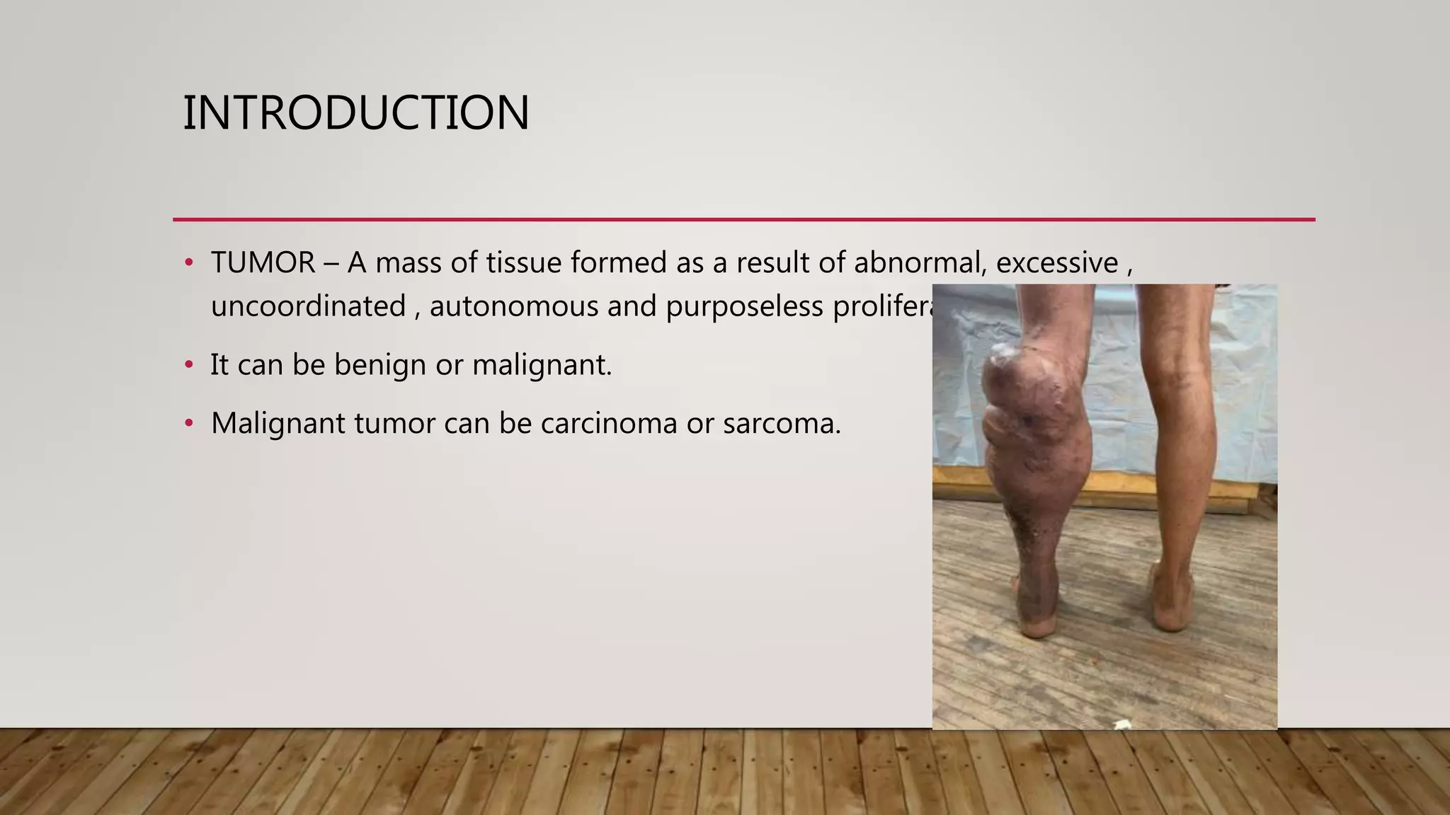 Classification in orthopaedic oncology | PPTX