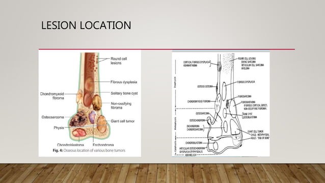 Classification in orthopaedic oncology | PPTX | Cancer | Diseases and ...