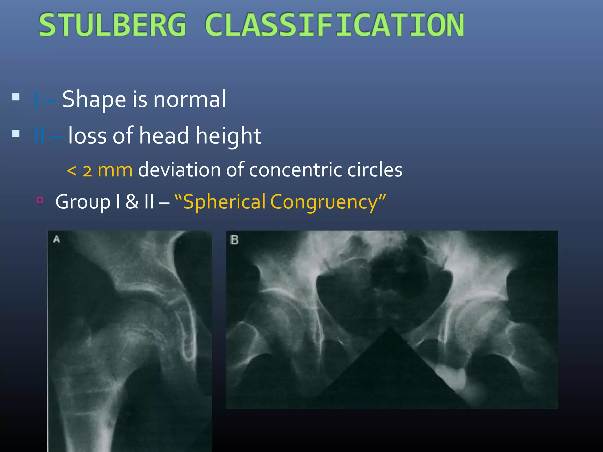 Classification & management of legg calve perthes disease | PPT