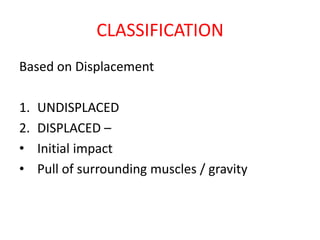 Classification of fractures in general | PPTX
